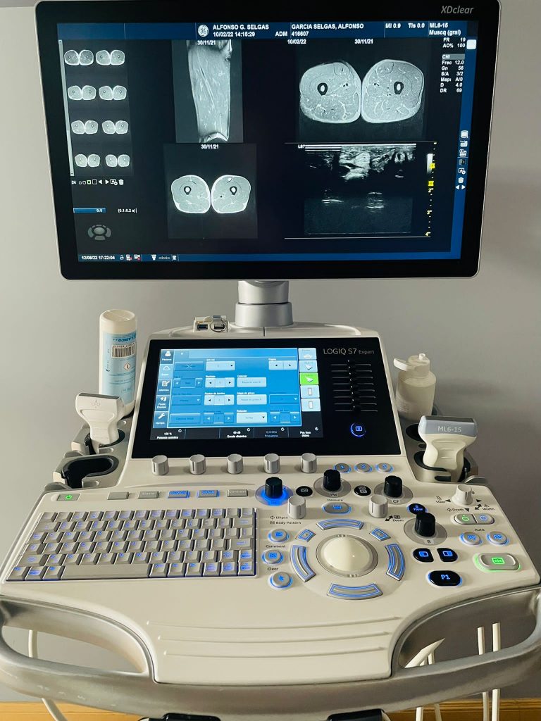ECOGRAFO ELECTRIC LOGIC – AGS Fisioterapia Avanzada